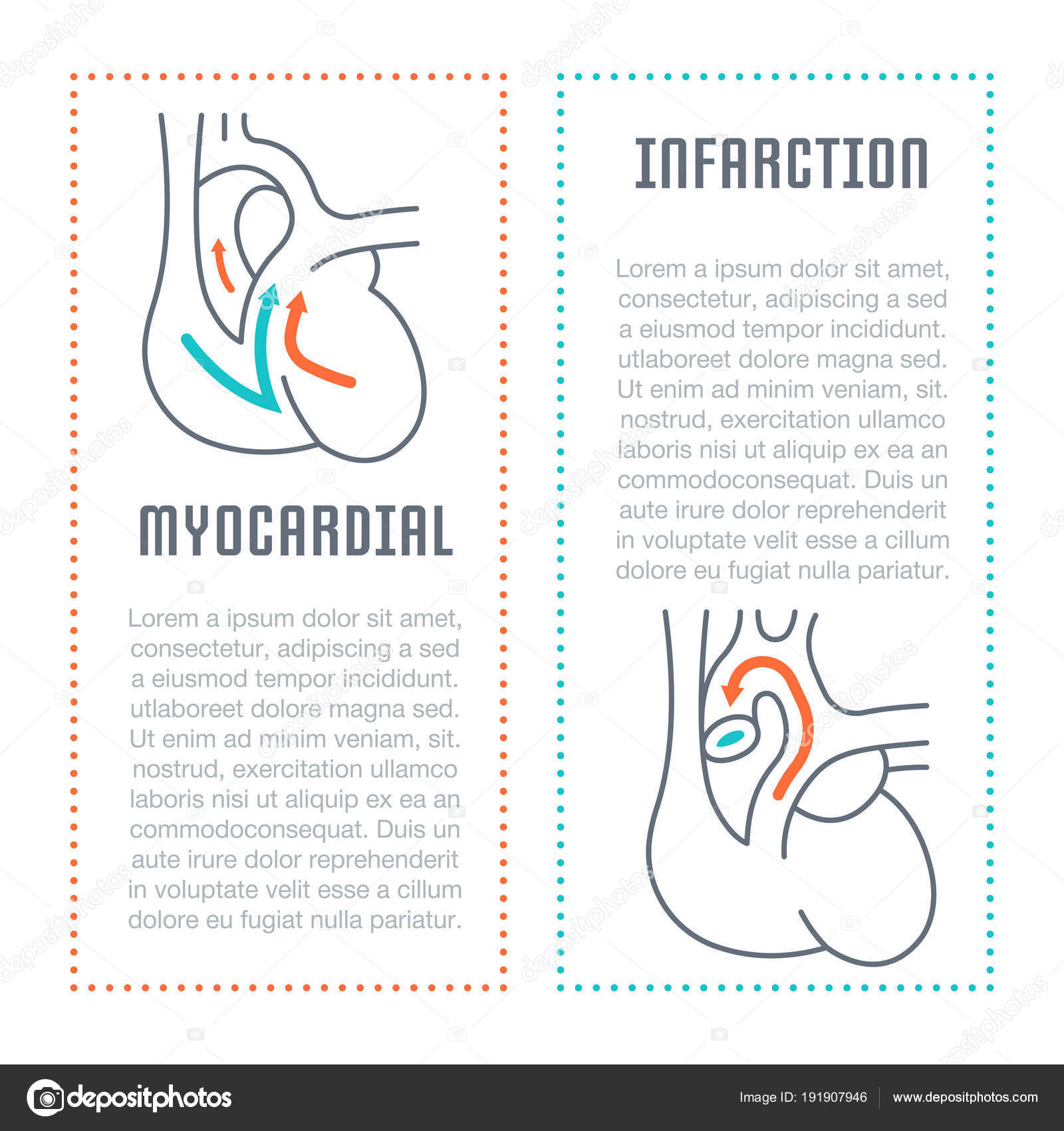 Website Banner and Landing Page of Myocardial Infarction. Stock Vector ...