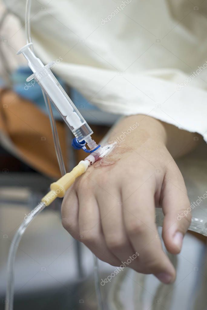 inyección intravenosa al niño. Mano de un niño con una aguja. Sistema ...