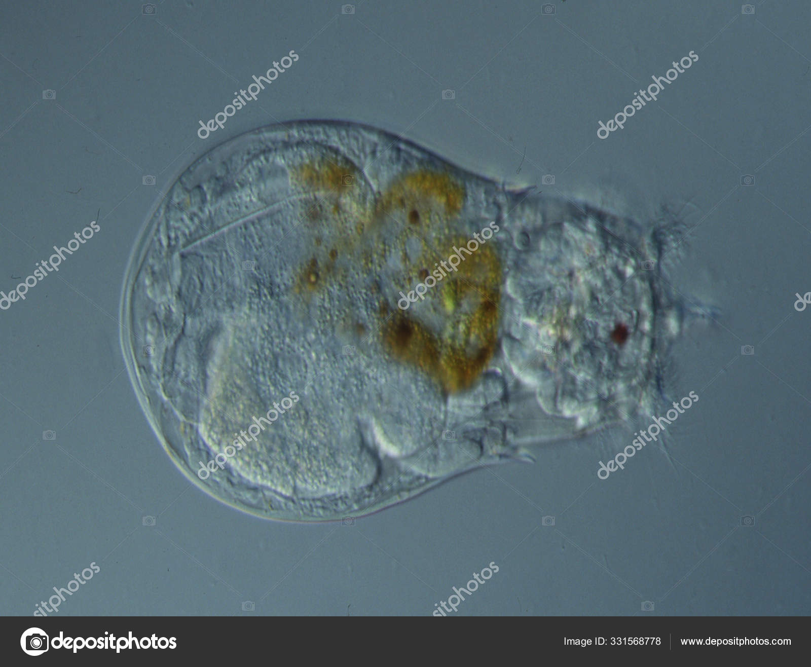 Paramecium Under Microscope 100x