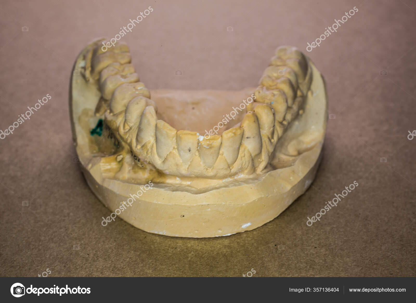 Upper Jaw Impression Plaster Model — Stock Photo © dr.lange.unitybox.de ...