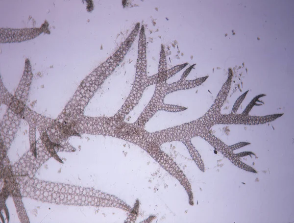 Rhizopus arrhizus Stock Photos, Royalty Free Rhizopus arrhizus Images ...