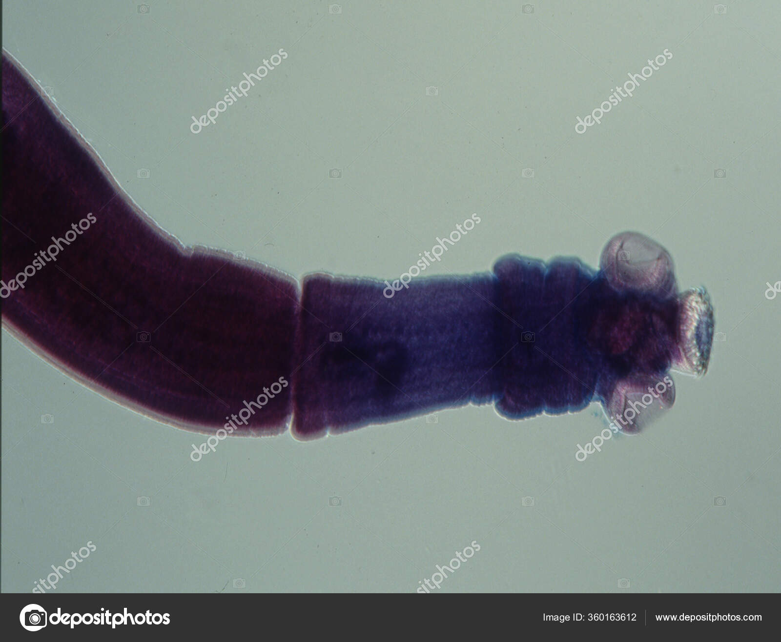 Tapeworm Limbs Microscope Stock Photo by ©dr.lange.unitybox.de 360163612