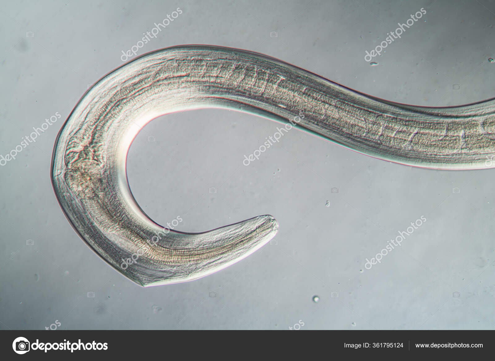 Pinworm Under Microscope