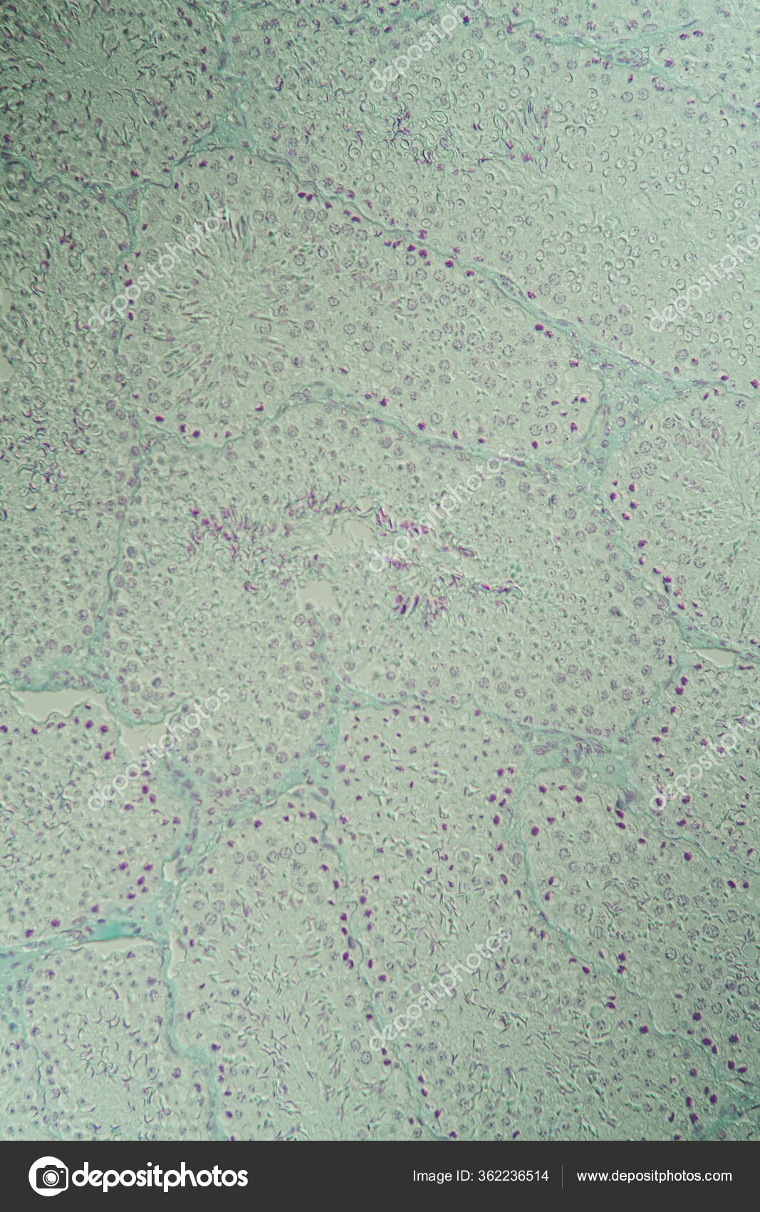 Testicle Cross Section Microscope 100X — Stock Photo © dr.lange ...