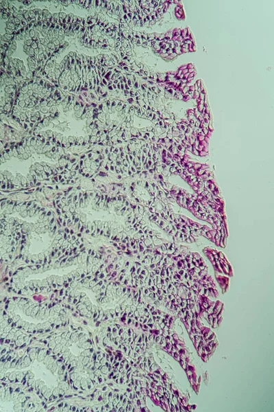 Polypes intestinaux Stock Photos, Royalty Free Polypes intestinaux ...