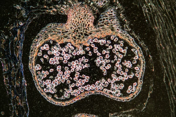 Basal roots Stock Photos, Royalty Free Basal roots Images | Depositphotos