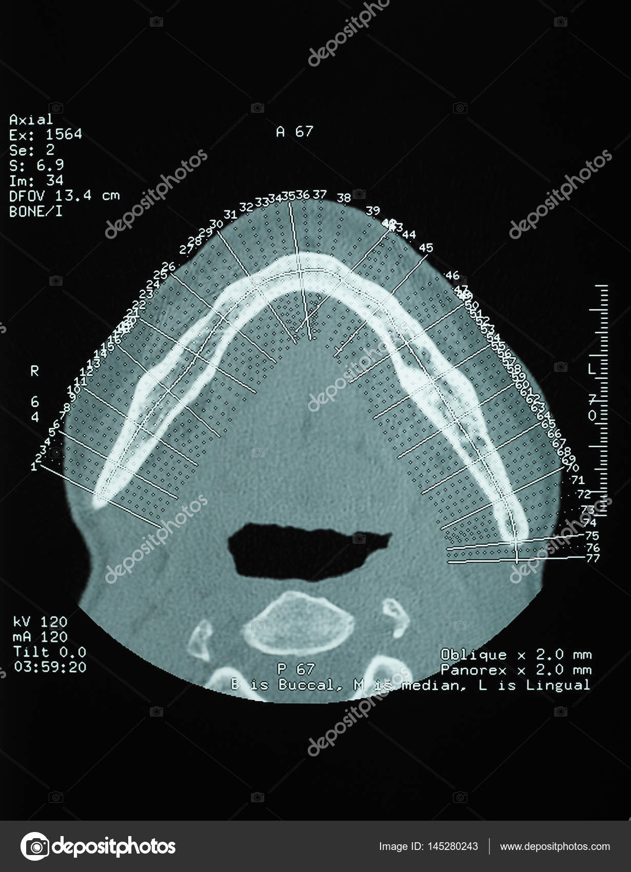 Scan Aka Cat Scan Cross Sectional Tomographic Images Ray Human — Stock ...