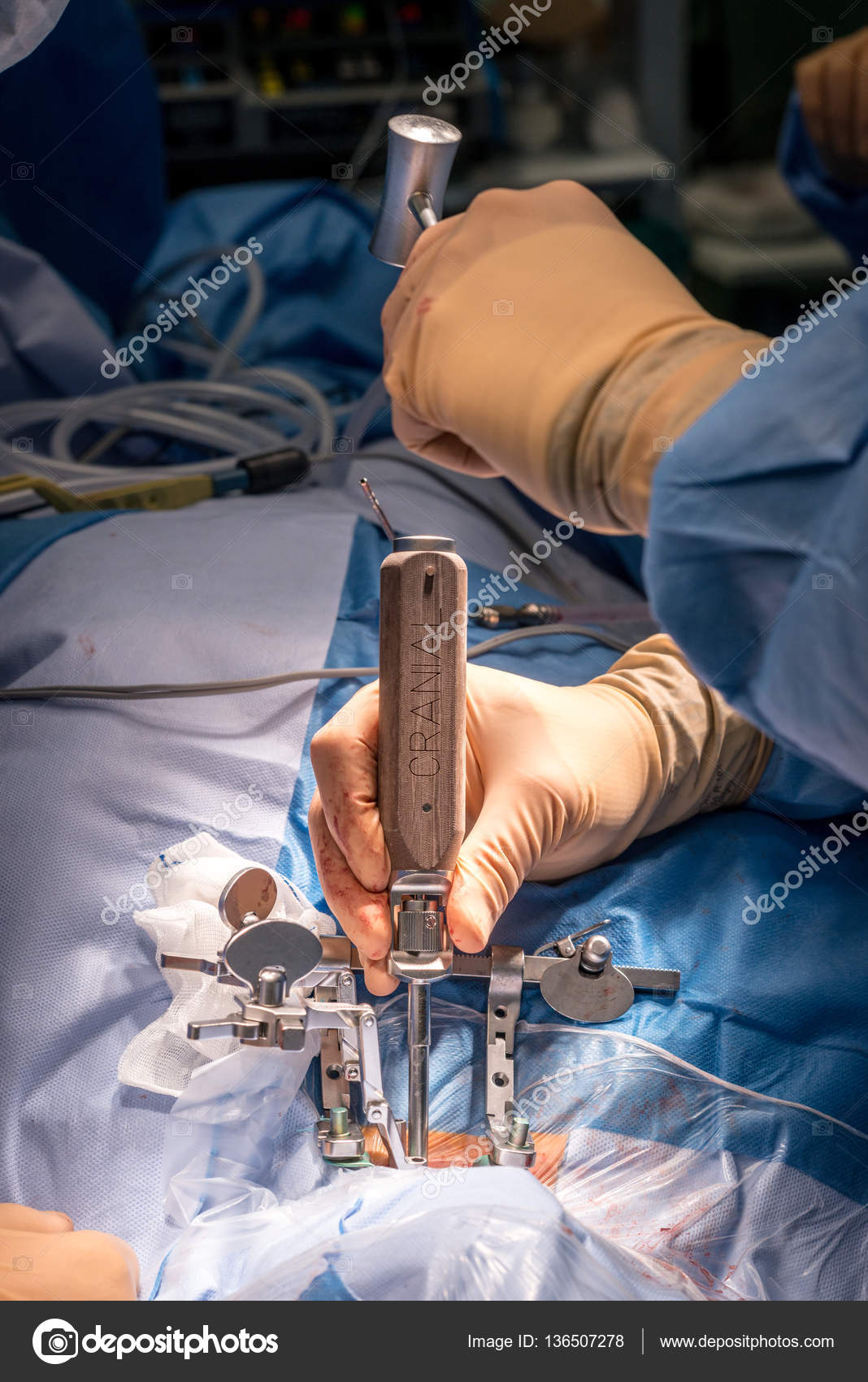 Operación quirúrgica en el quirófano: fotografía de stock © vpardi ...