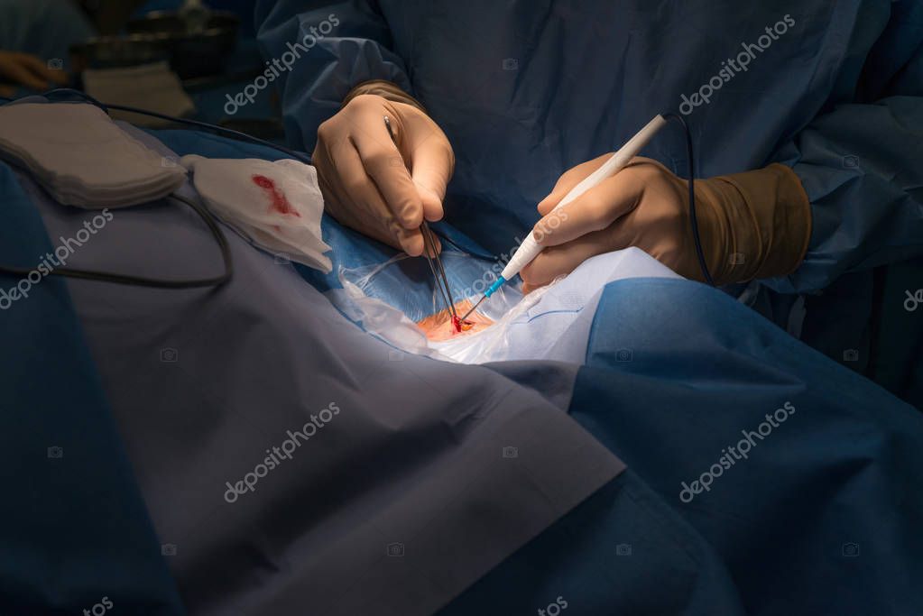 operación quirúrgica en el quirófano 2023