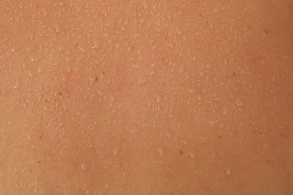 Human Skin and Sweat — Stock Photo © Gap #130829198