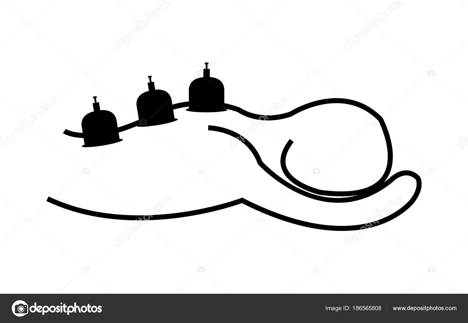 Práctica Ventosas Hijama Hecha Una Persona Vector de stock #186565808 ...