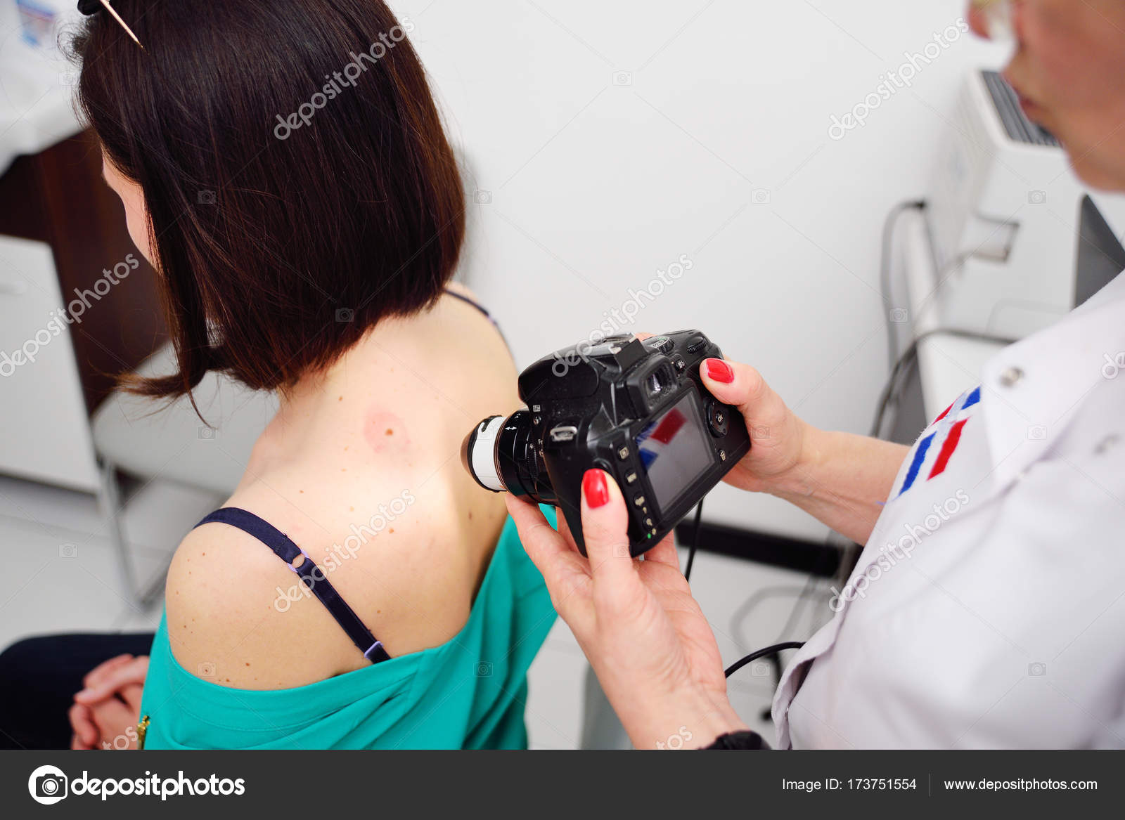 The Dermatologist Examines The Moles Or Acne Of The Patient With A