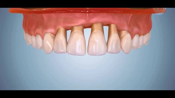 Schematic Animation Showing What Parts Ball Attachment Superstructure ...