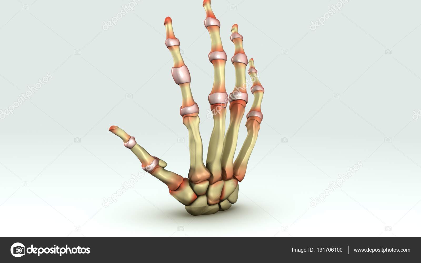 Rheumatoid arthritis close up — Stock Photo © sciencepics #131706100