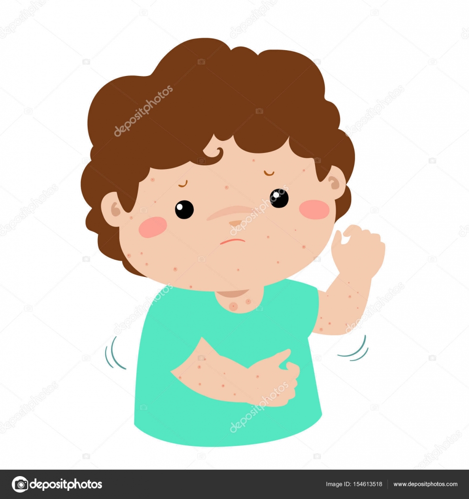 Boy scratching itching rash on his body vector. Stock Vector Image by ...