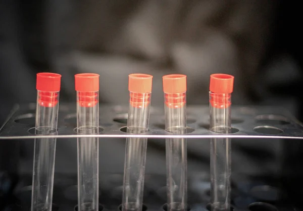 Rows of laboratory test tubes use for experiment scientist. For the ...