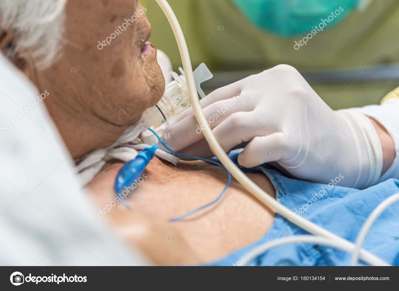 Ventilator Patient Trach