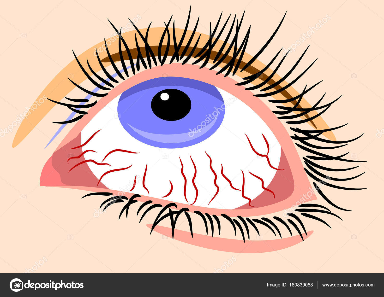 Red Watery Eyes Clipart