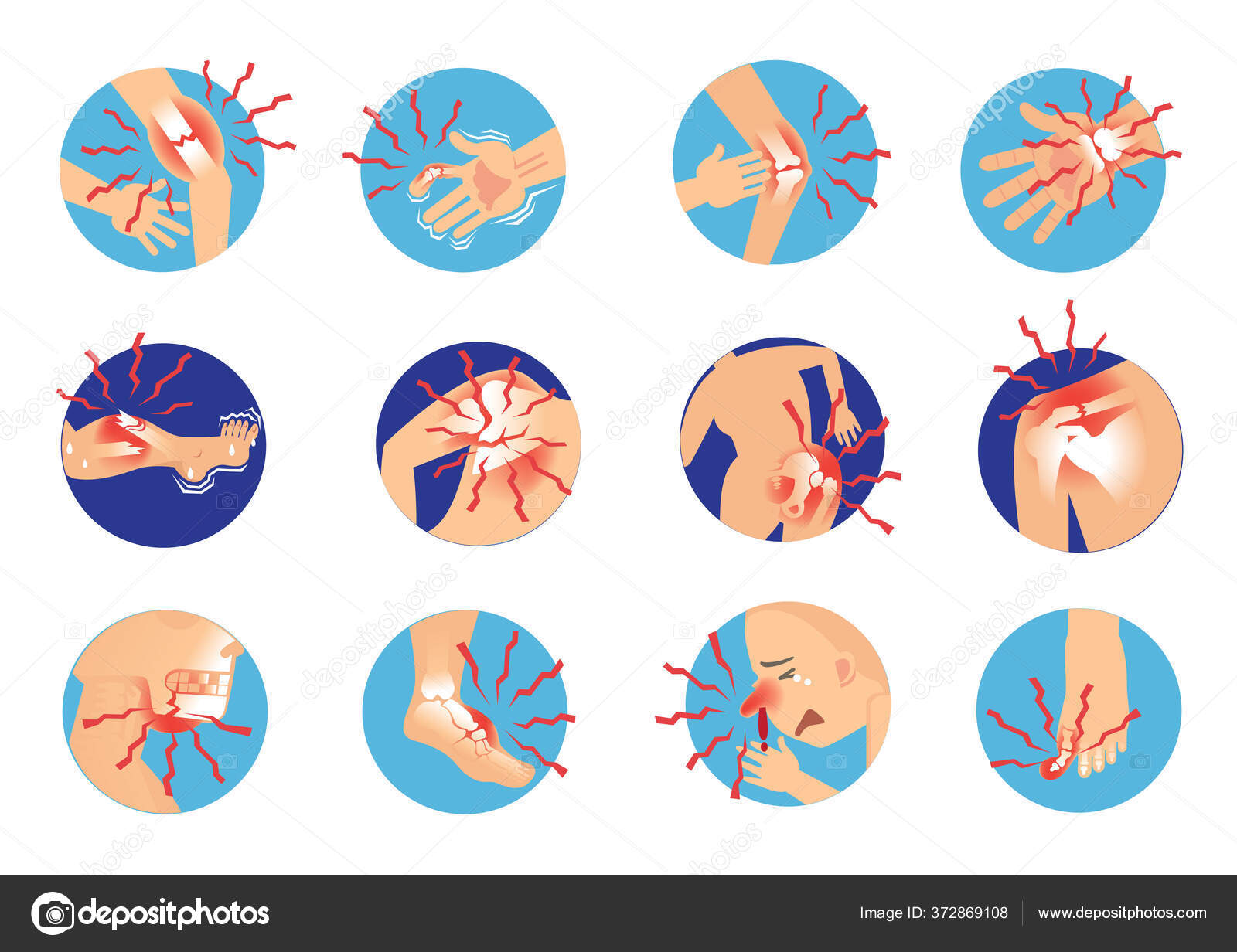 Hueso Roto Vector Ilustración Vector de stock #372869108 de ©ann131313