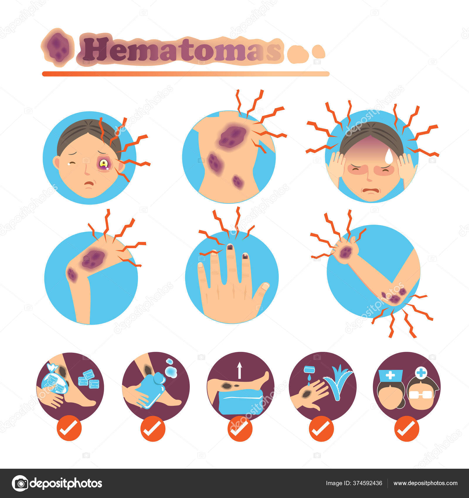 Hematomas Set Vector Illustration Stock Vector Image by ©ann131313 ...