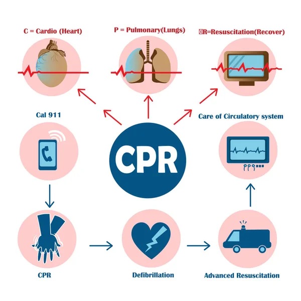 Cpr steps Vector Art Stock Images | Depositphotos
