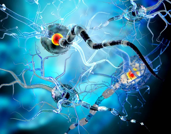 3d illustration of nerve cells, concept for Neurological Diseases ...