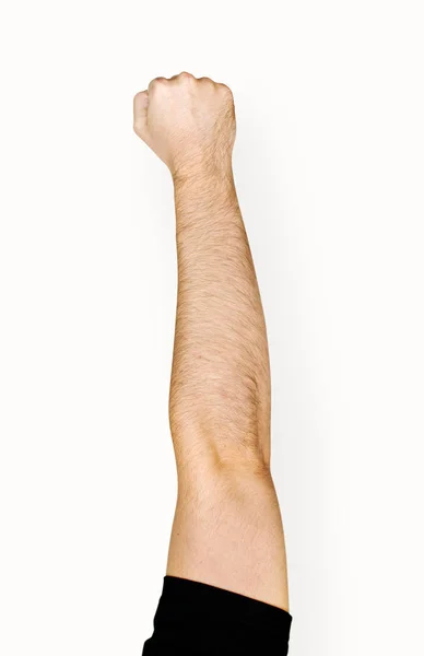 Swollen arm Stock Photos, Royalty Free Swollen arm Images | Depositphotos