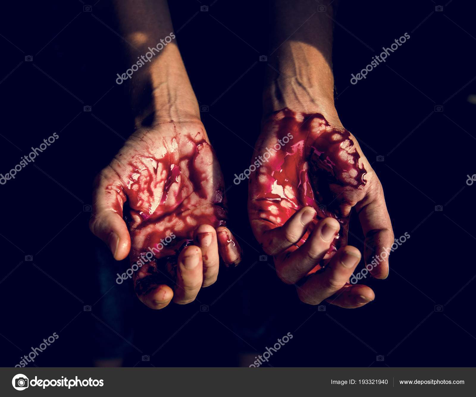 Severely Injured Bloody Hands Partial View — Stock Photo © Rawpixel ...