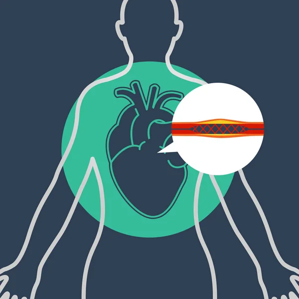 Cardiac catheterization vector logo icon design Stock Vector Image by ...