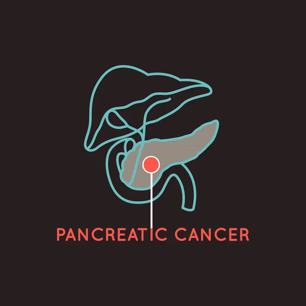 237 Pancreatic cancer Stock Illustrations | Depositphotos