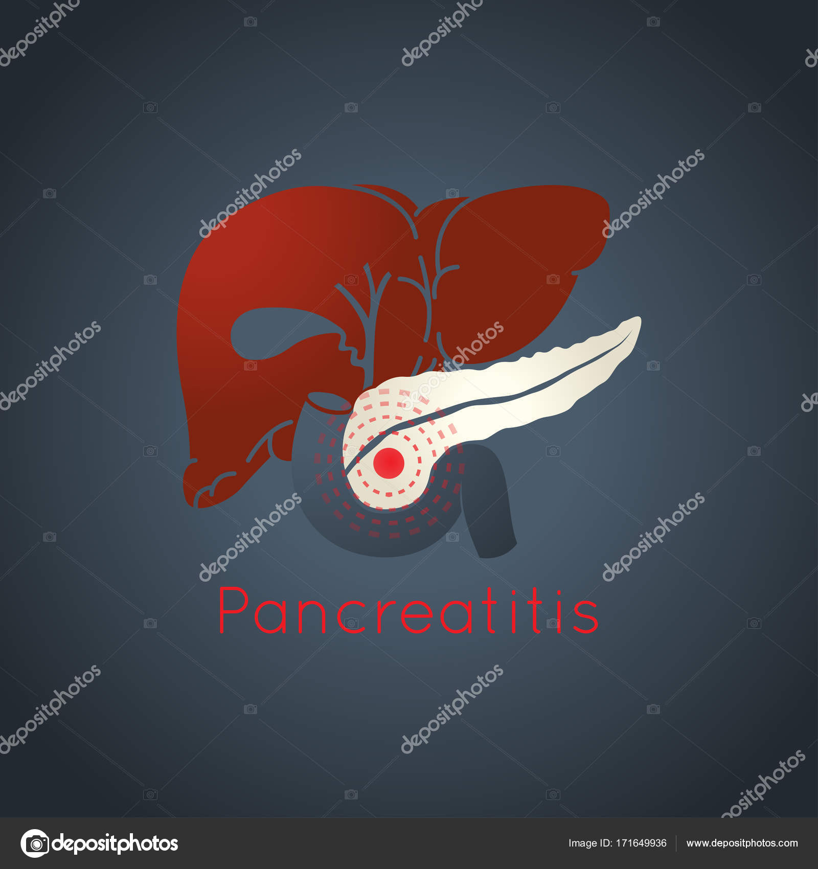 Pancreatitis vector logo icon illustration Stock Vector Image by ...