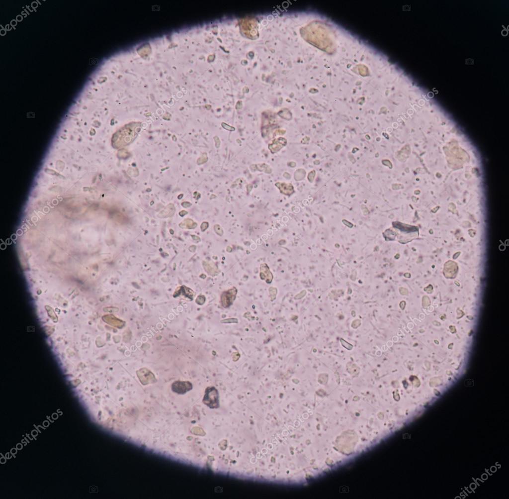 Bacteria in Urinary Tract Infections. — Stock Photo © toeytoey #126132122