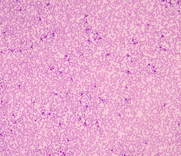 Sepsis or septicaemia is a life-threatening illness. Stock Photo by ...