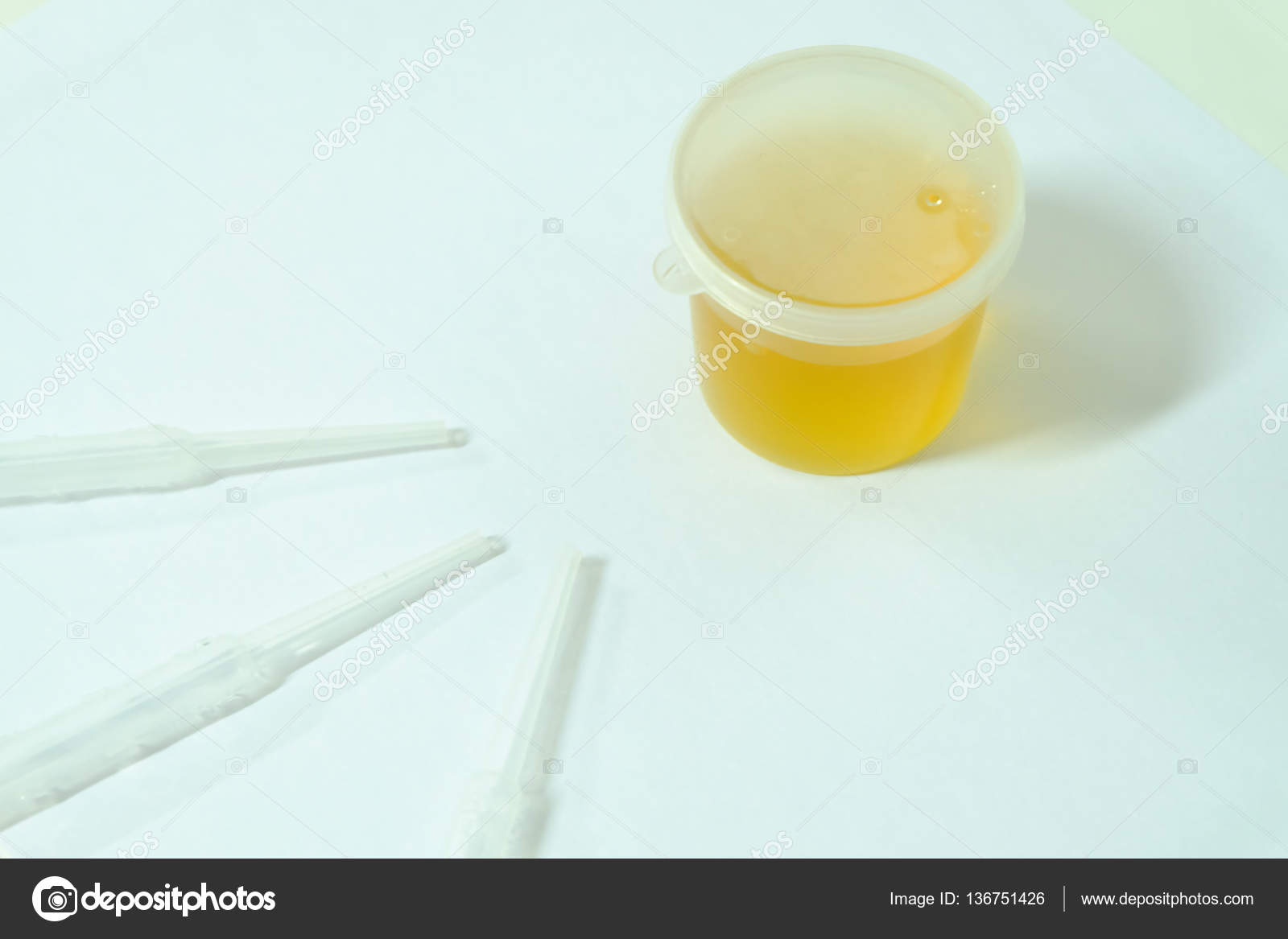 Urine sample for laboratory analysis — Stock Photo © toeytoey #136751426