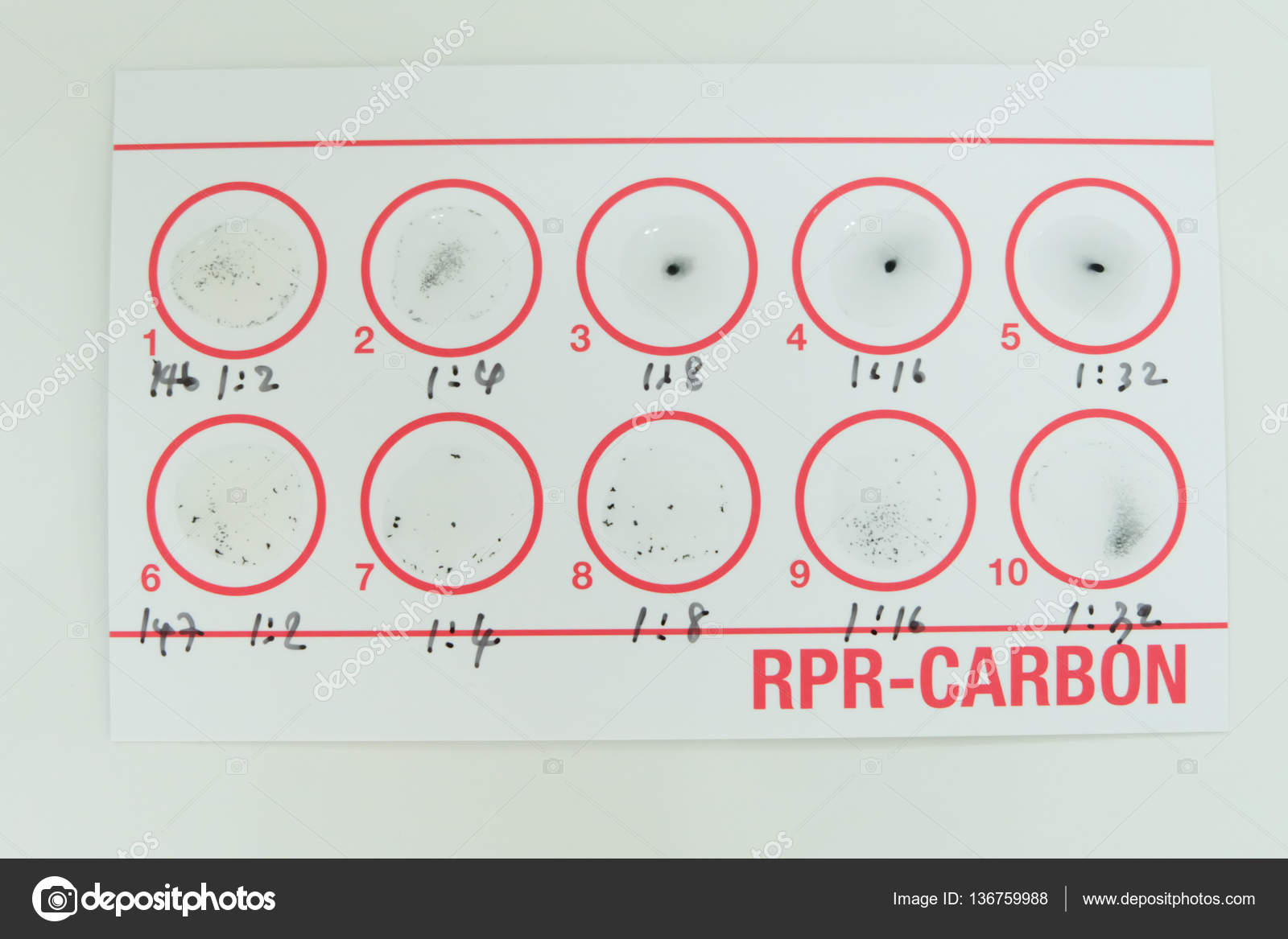 what is an rpr test - hiccups pregnancy