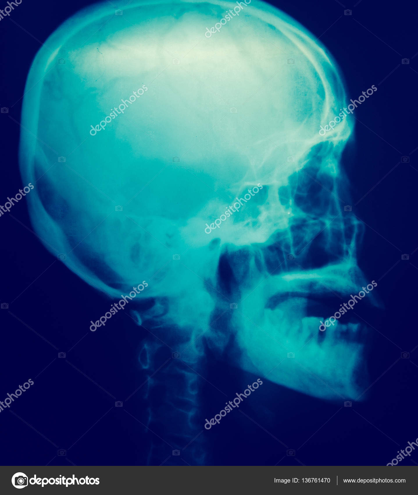 X-ray in blue tone — Stock Photo © toeytoey #136761470