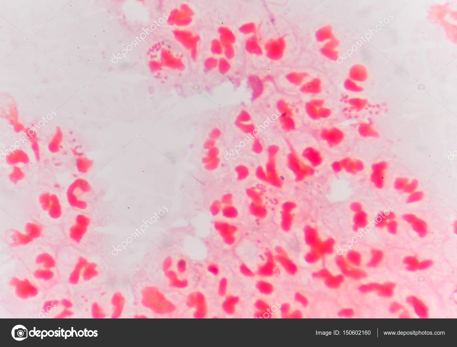 Gram negative diplococci intracellular — Stock Photo © toeytoey #150602160