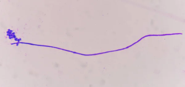 Imágenes de Células de levedura pseudohifas, fotos de Células de ...