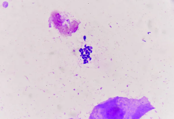 Budding yeast cells with pseudohyphae from sputum gram stain tes ...