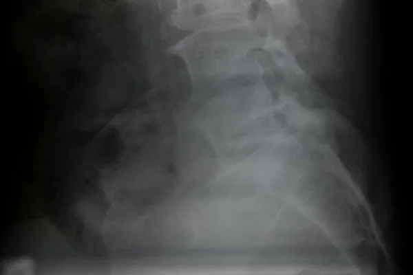 Spinal dislocation Stock Photos, Royalty Free Spinal dislocation Images ...