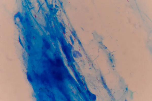 Dye in cells Stock Photos, Royalty Free Dye in cells Images | Depositphotos