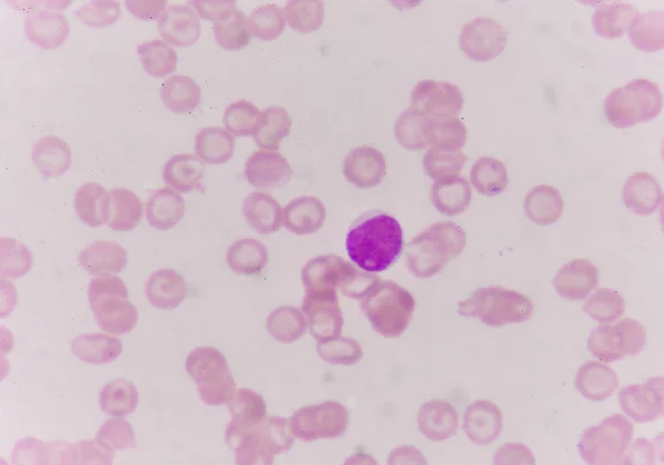 Blast cell Stock Photos, Royalty Free Blast cell Images | Depositphotos