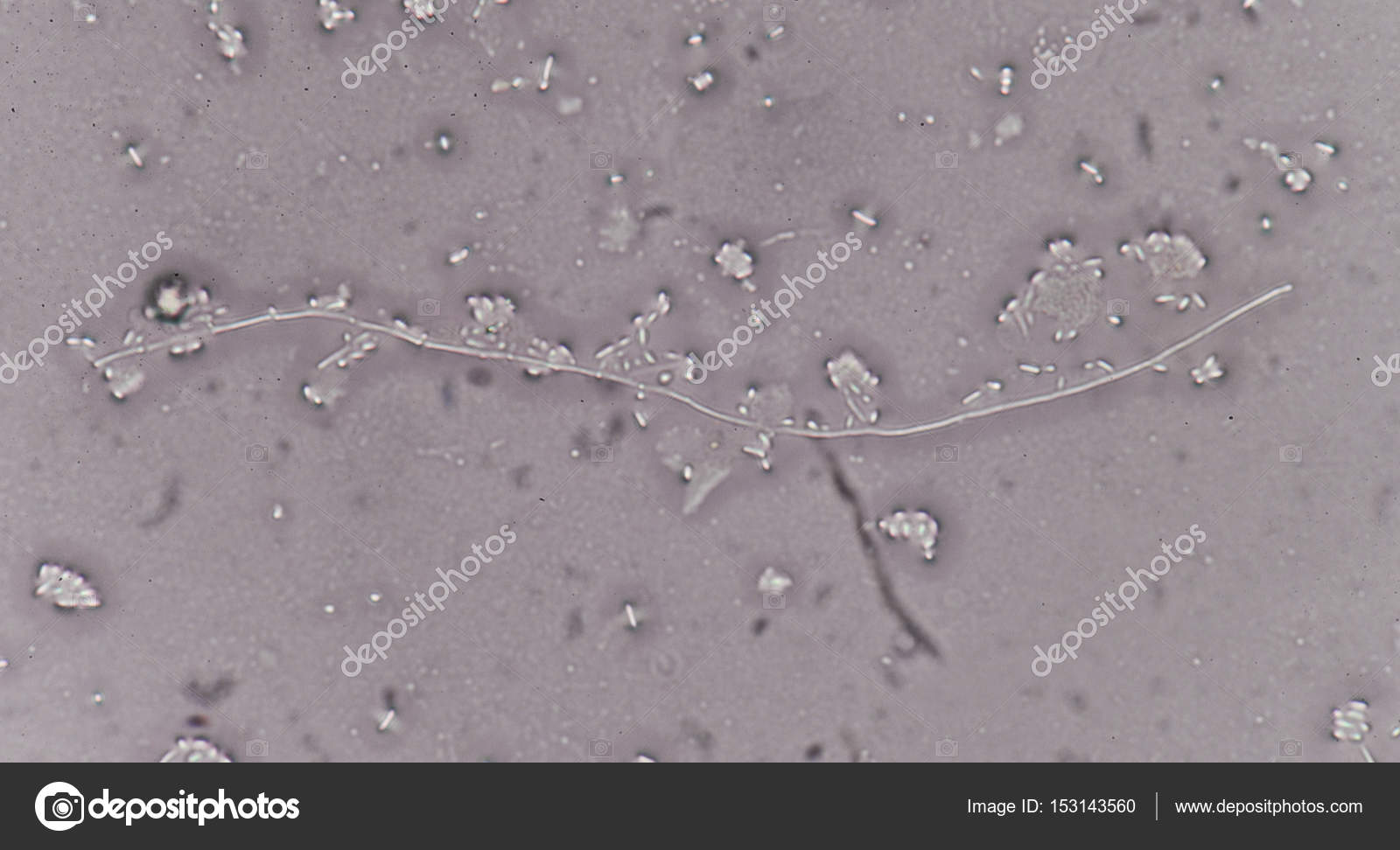 Yeast cells in urine specimens. Stock Photo by ©toeytoey 153143560