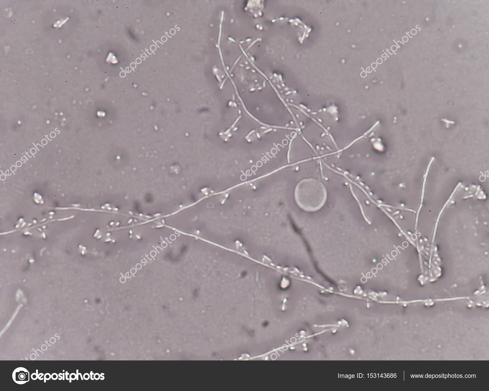 Yeast Cells In Urine Yeast Cells In Urine Specimens. Stock Photo
