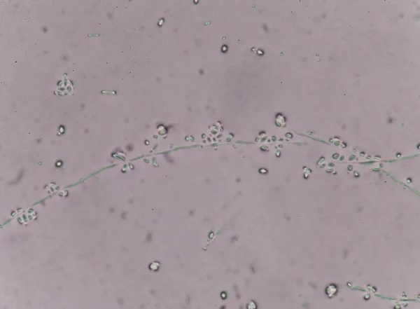 Yeast cells in urine sample. — Stock Photo © toeytoey #153143388