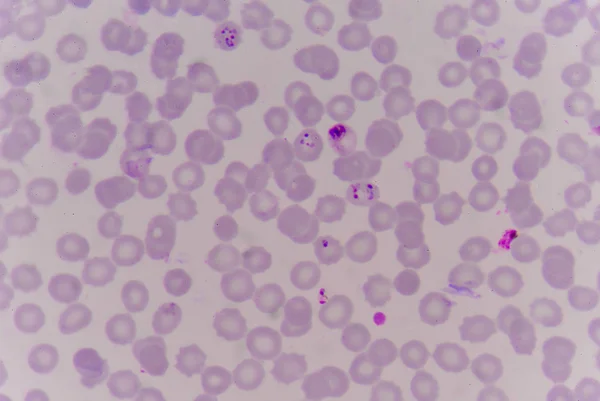 360 illustrations de Parasite cutané | Depositphotos