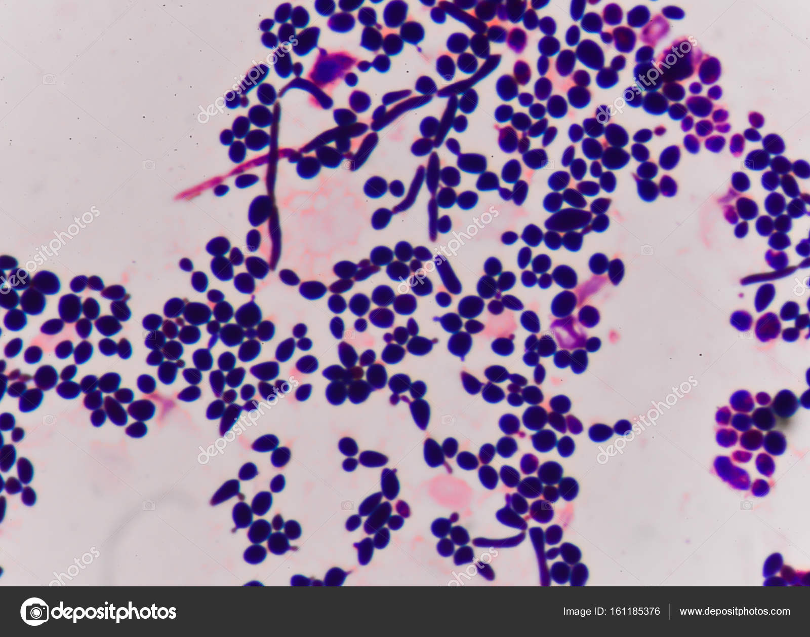 Budding yeast cell structure Stock Photo by ©toeytoey 161185376