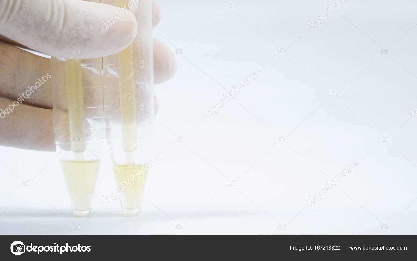 Urine analysis on white. Stock Photo by ©toeytoey 167213822