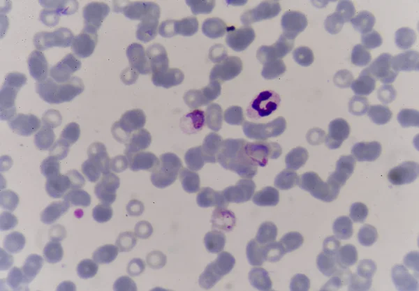 A nucleated red blood cell, or NRBC, is a red blood cell (RBC) t Stock ...