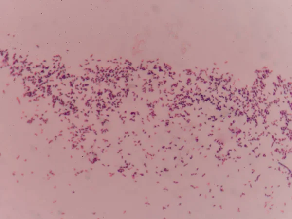 gram stain test showing bacteria cells. - Stock Image - Everypixel